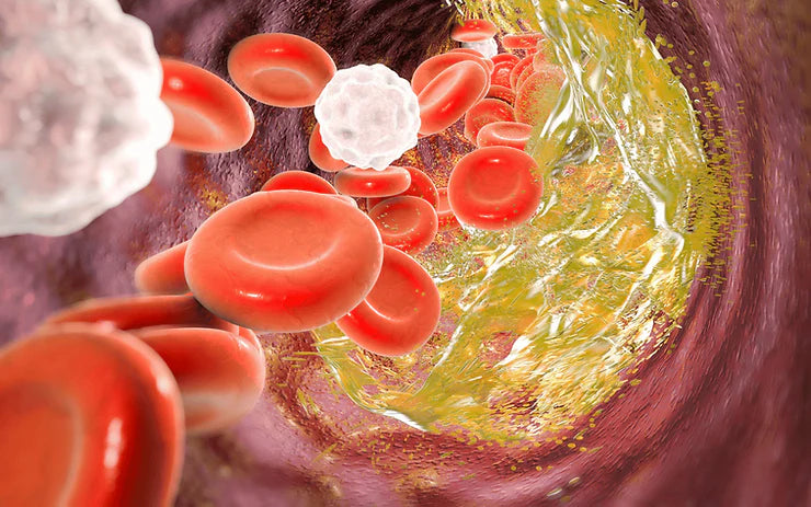 LDL-kolesteroli: Kaikki mitä sinun tulee tietää – Glucavena